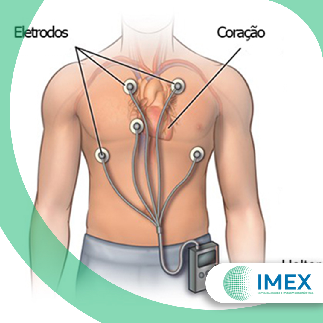 Imex Holter 24 Horas Imex Holter 24 Horas